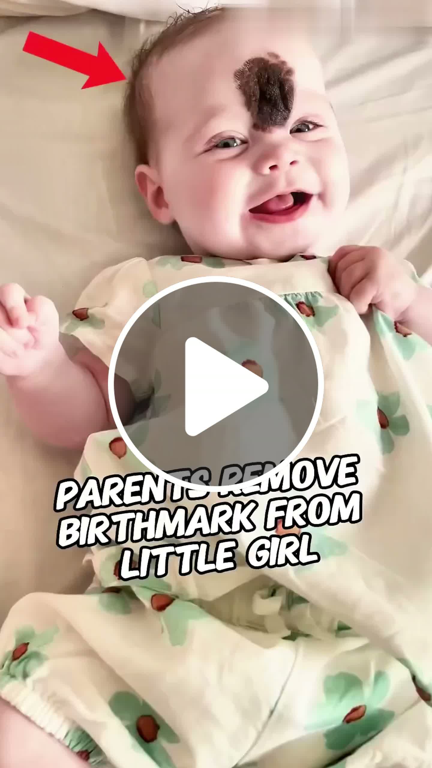 Parents help the little girl remove birthmarks #funny #love #like #cute ...