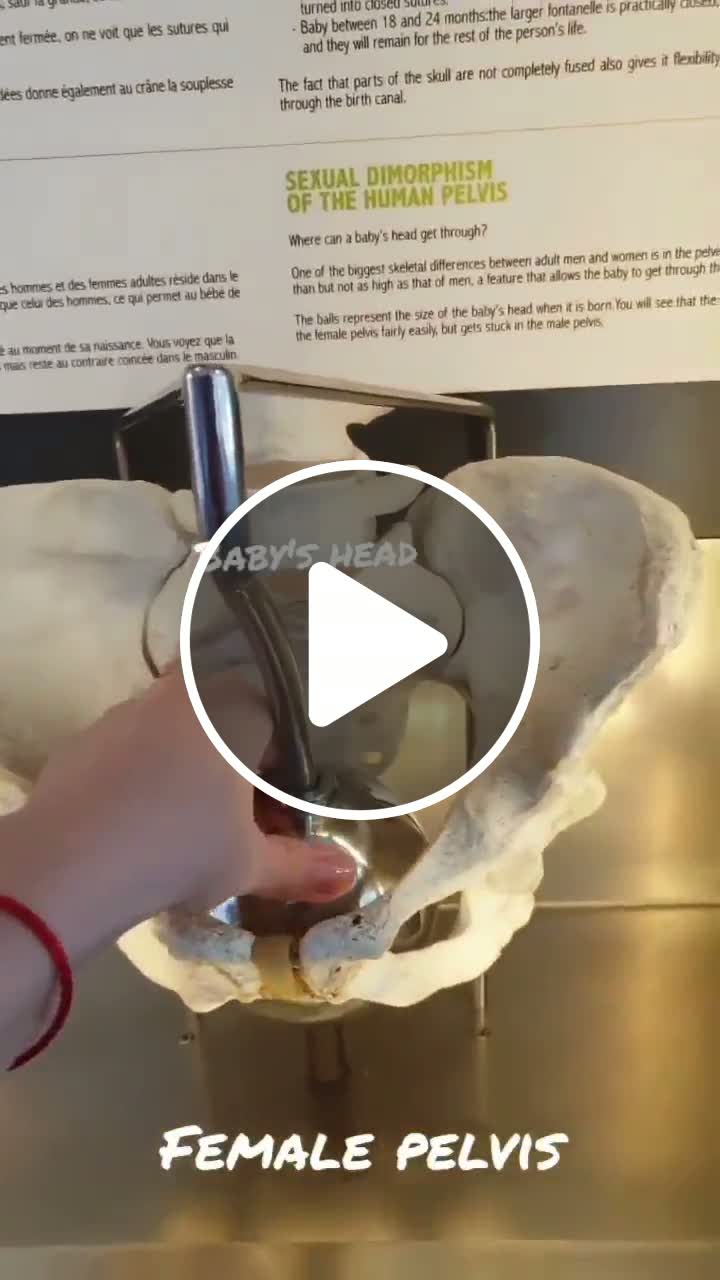 The difference between a male and female pelvis, The ball represents a ...