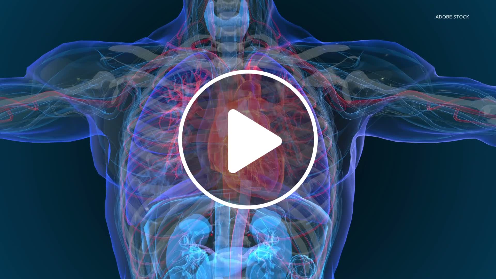 Study finds 99 percent of heart attack, stroke victims had these common risk factors: HealthLink ...