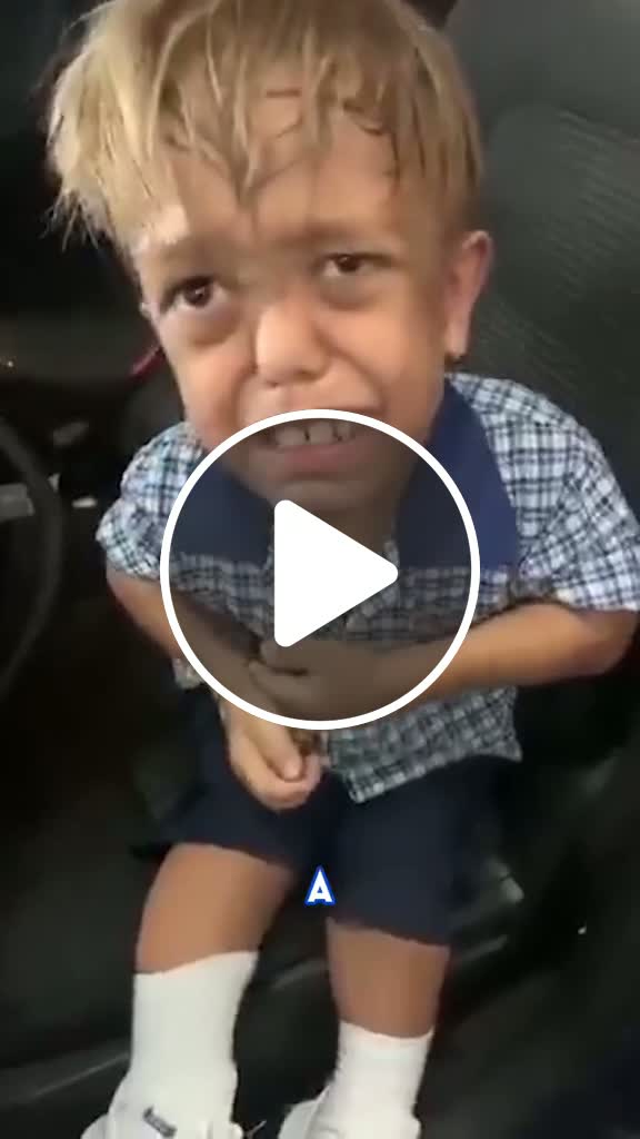 A child who was bullied for his dwarfism is now a Hollywood actor ...