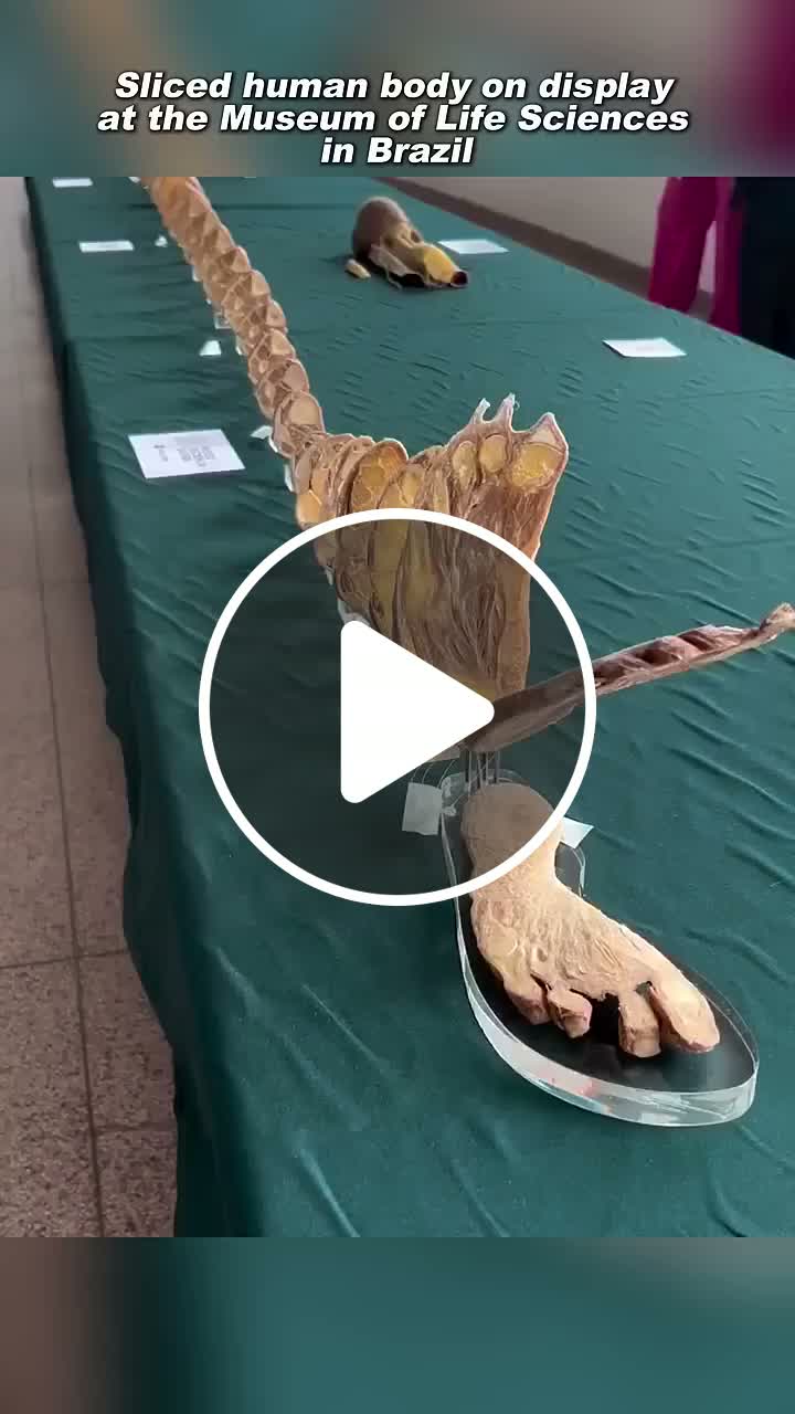 Check out this fascinating sliced human body! 🤯 #Anatomy #Wow # ...