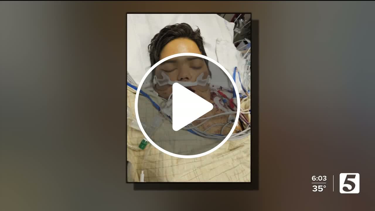 College student nearly dies from histoplasmosis in Tennessee - NewsBreak