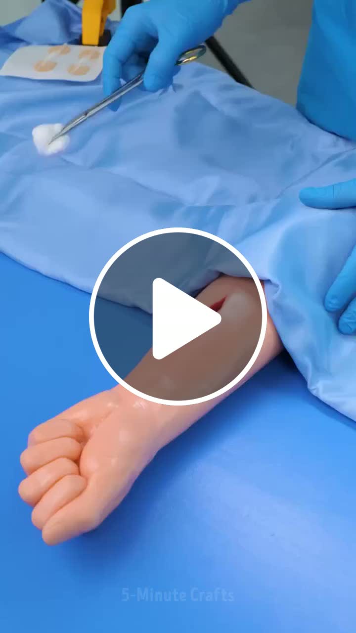 This Is the Right Way to Treat a Cut - NewsBreak