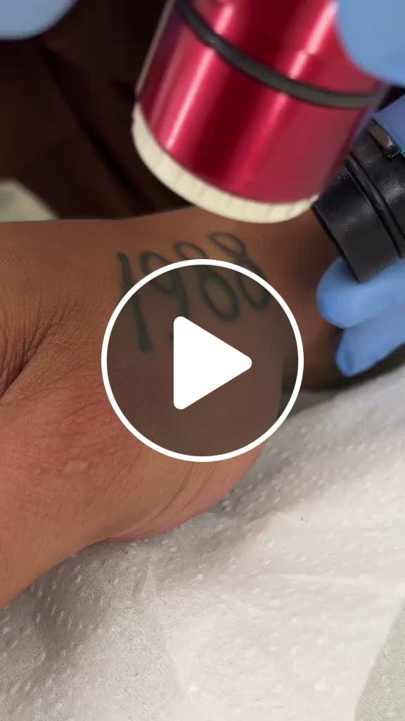 Tattoo body machine - NewsBreak