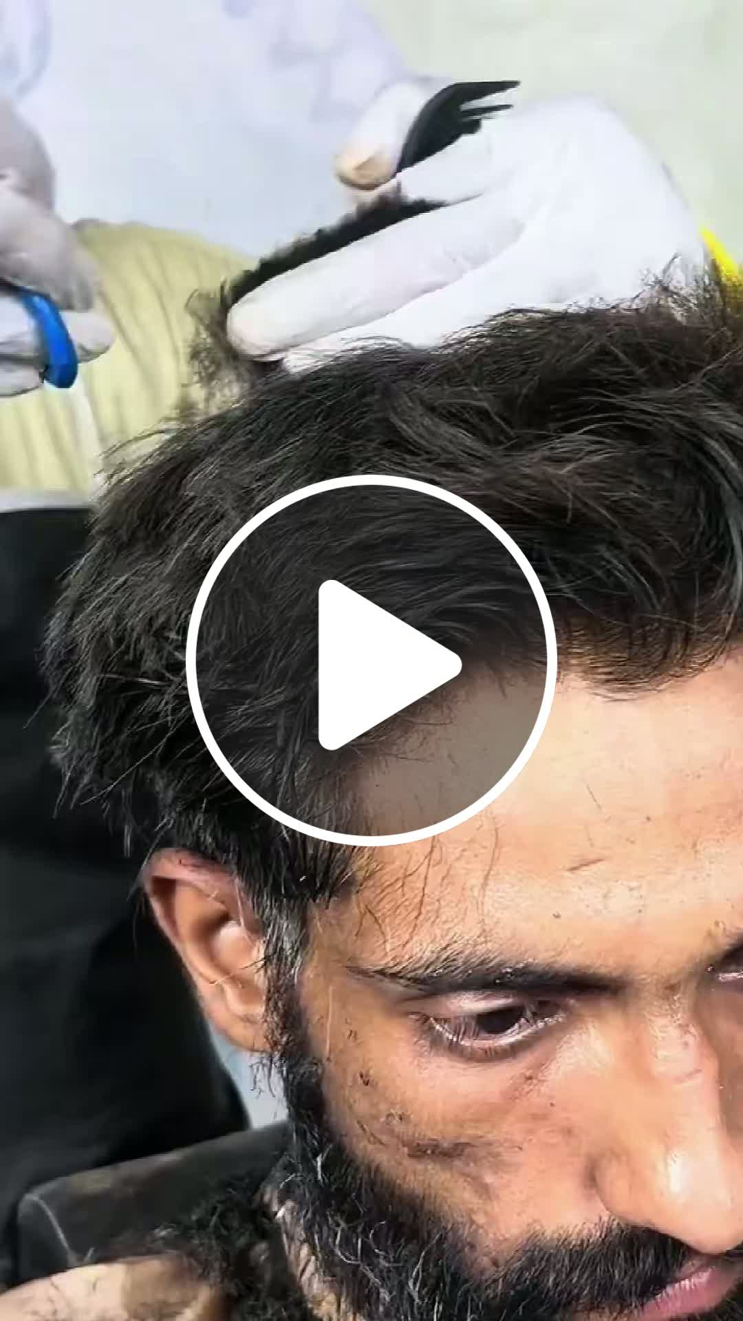 You Wont Believe This 10-Year Without Haircut Homeless Man _ INSANE B ...