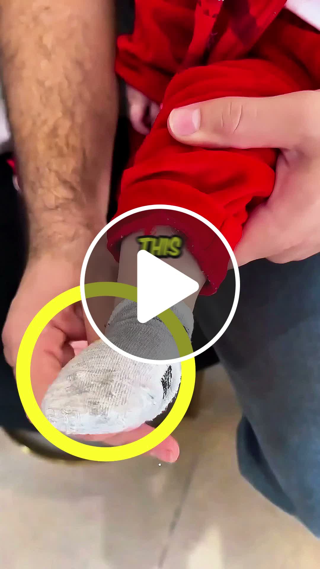 He Was Born With 6 Fingers! #interestingfacts - NewsBreak