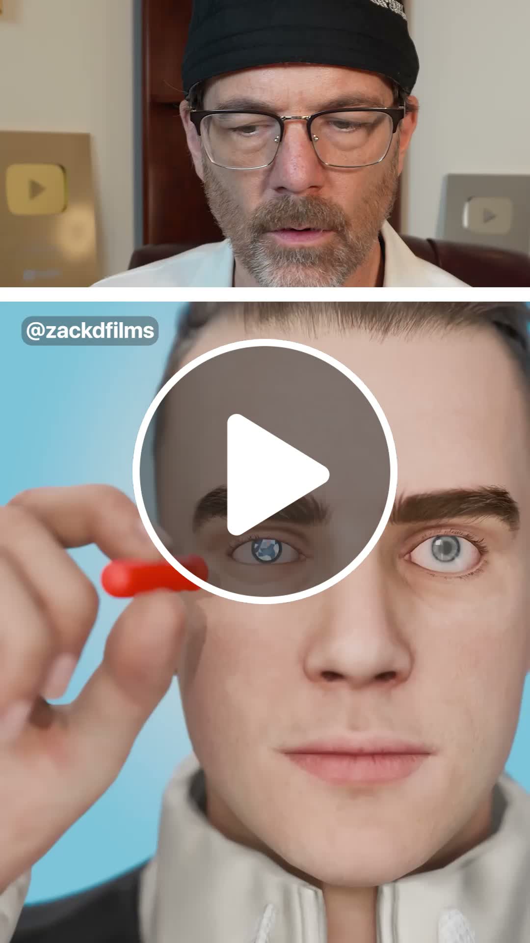 The Man With A Two-Carat Diamond Eye Surgeon Reacts - NewsBreak